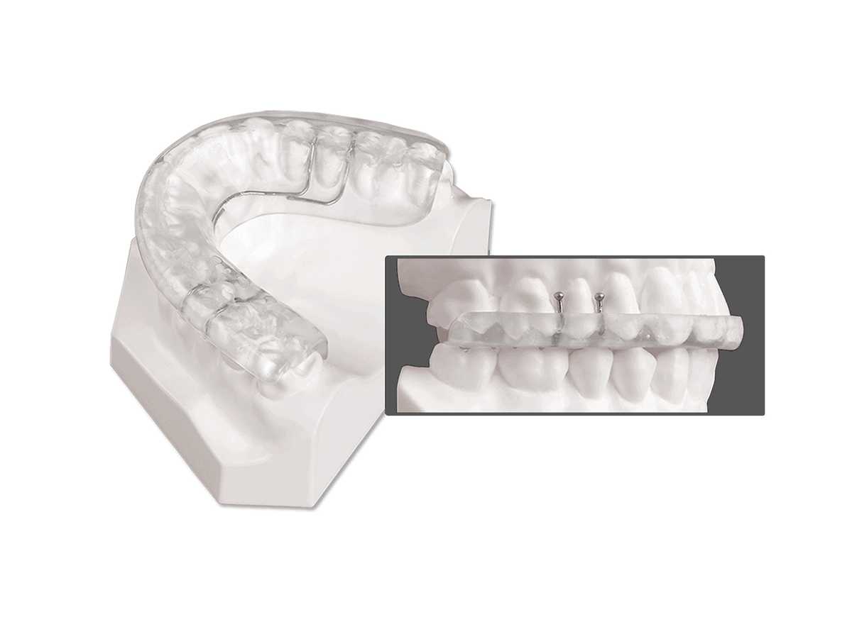 dental services: TMD and Splints | Gippsland Prosthodontics